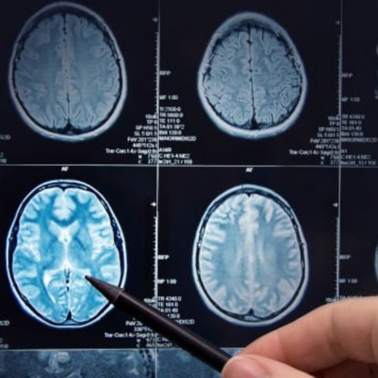 X Ray Vs Ct Scan Vs Mri How To Have Better Dialogue With Your Doctor